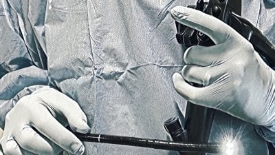 Grading Erosive Esophagitis: the Los Angeles Classification – IWGCO